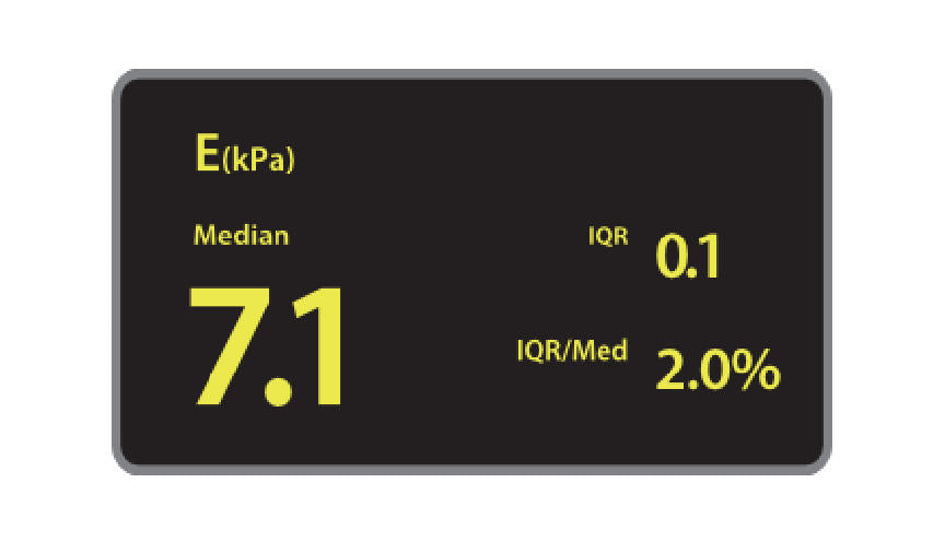 Mindray Ultrasound System Hepatus 5 - Series – MavenImaging