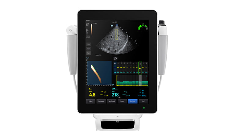 Mindray Ultrasound System Hepatus 5 - Series – MavenImaging