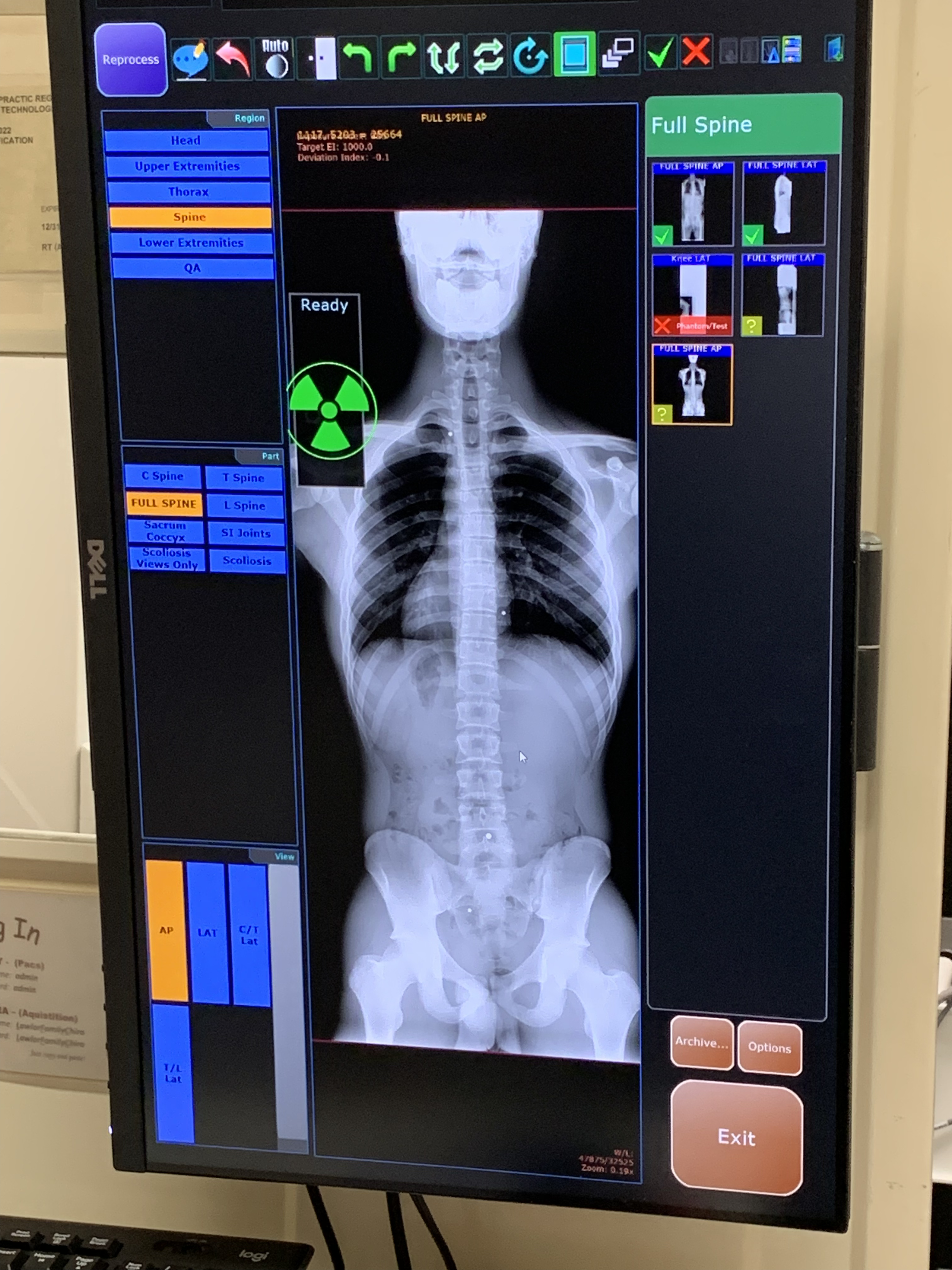 20/20 CFPT 17x48 Full Spine Chiropractic DR Panel – MavenImaging