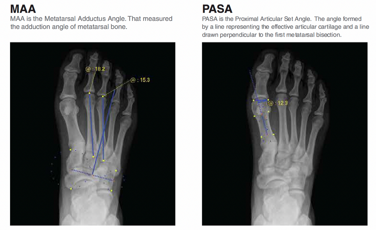 Rayance Podiatry x-ray system with 10x12 Wireless Panel Package ...