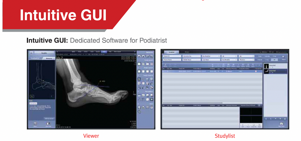 Rayance Podiatry x-ray system with 10x12 Wireless Panel Package ...