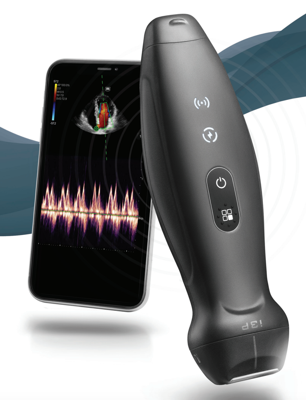 Mindray TE Air iPS – MavenImaging