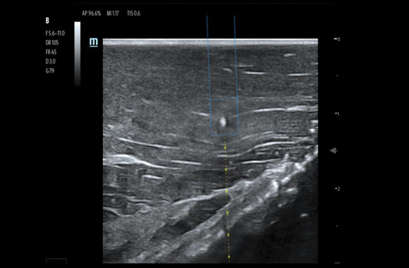 Mindray TE X Portable Ultrasound System – MavenImaging