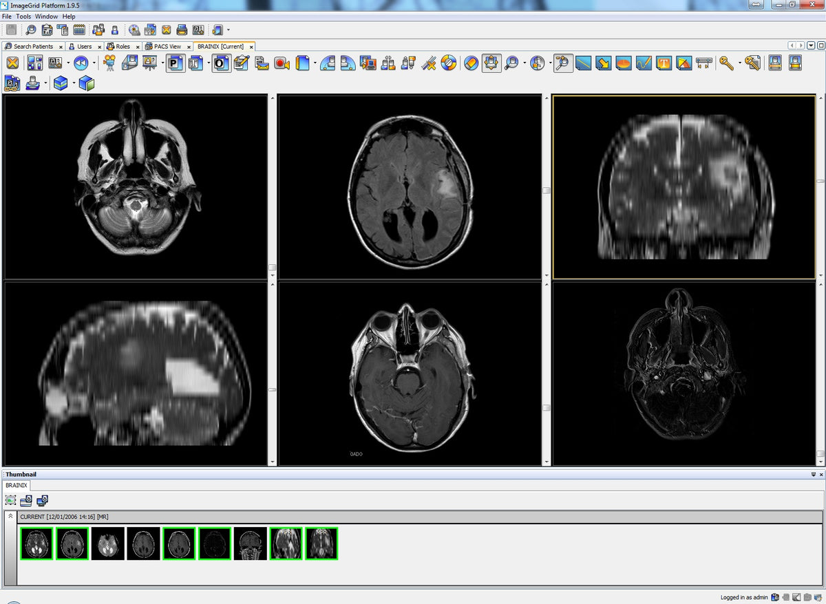 ImageGrid 1.8TB Mini-PACS System with DICOM Viewer and DICOM Storage ...
