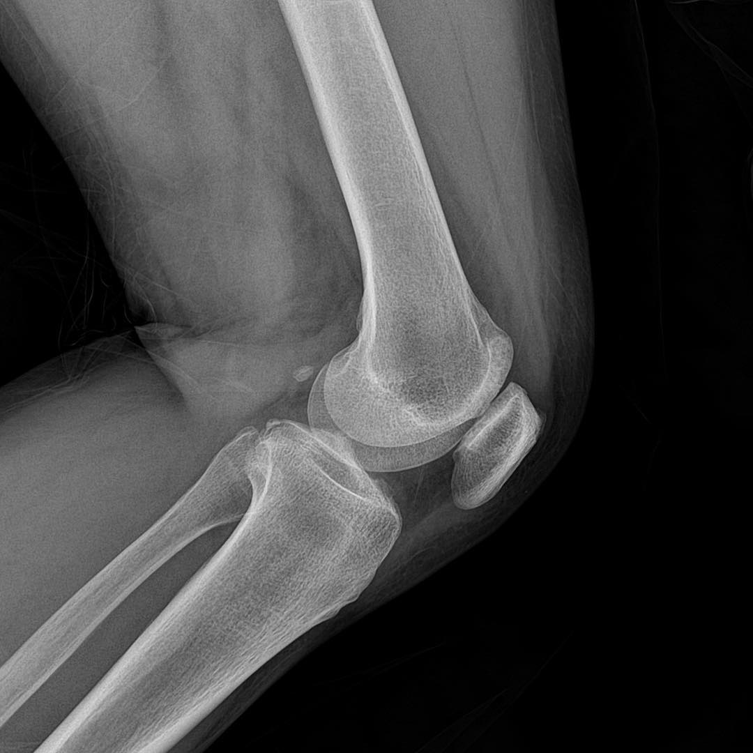 MinXray Portable X-ray System with Digital X-ray / DR Panel – MavenImaging