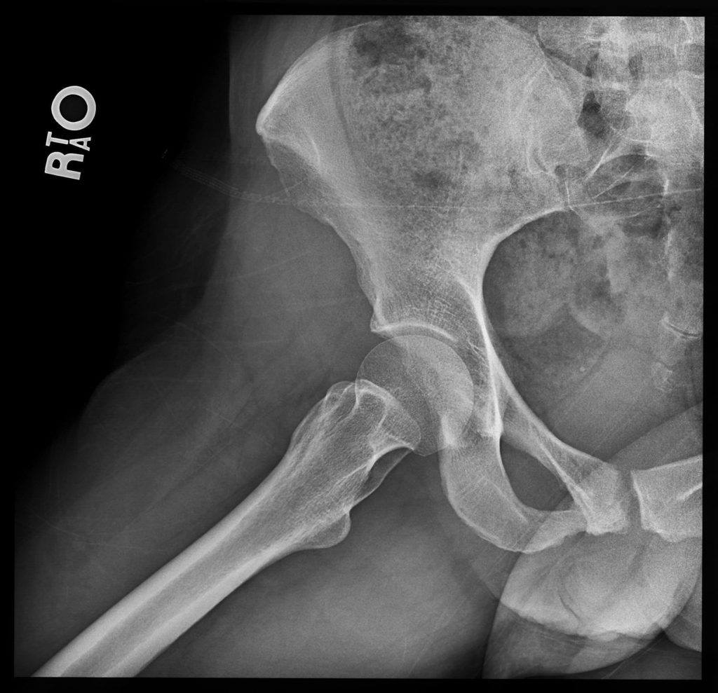 MinXray HF100H+ Portable X-ray System – MavenImaging