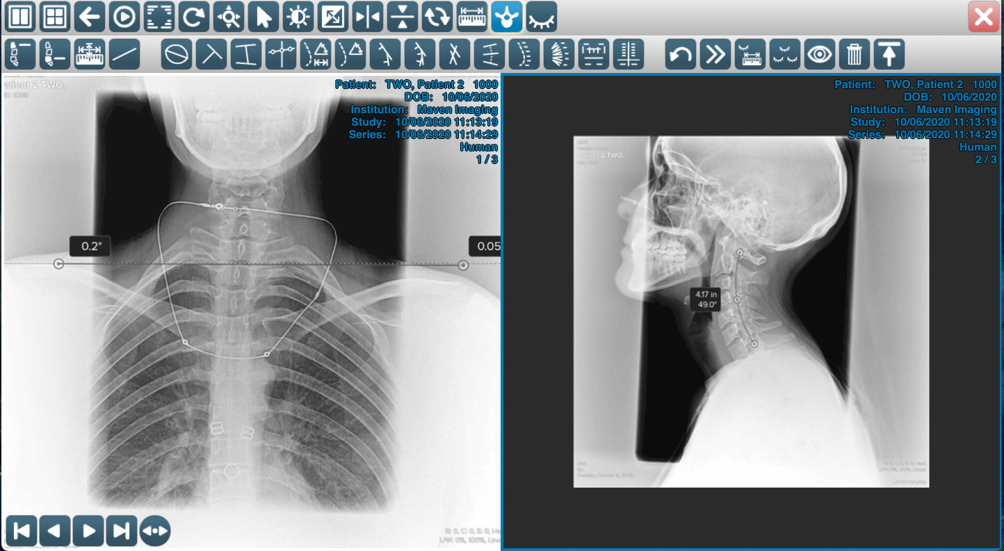 Chiropractic Cloud based digital x-ray software – MavenImaging
