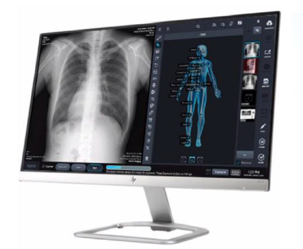 X-Cel X-ray 715-BD Series w/ PatientImage 14 x 17 Wireless DR Panel ...