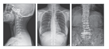 VIVIX-S 14 x 17 Wireless DR Panel with Viewworks Softare – MavenImaging