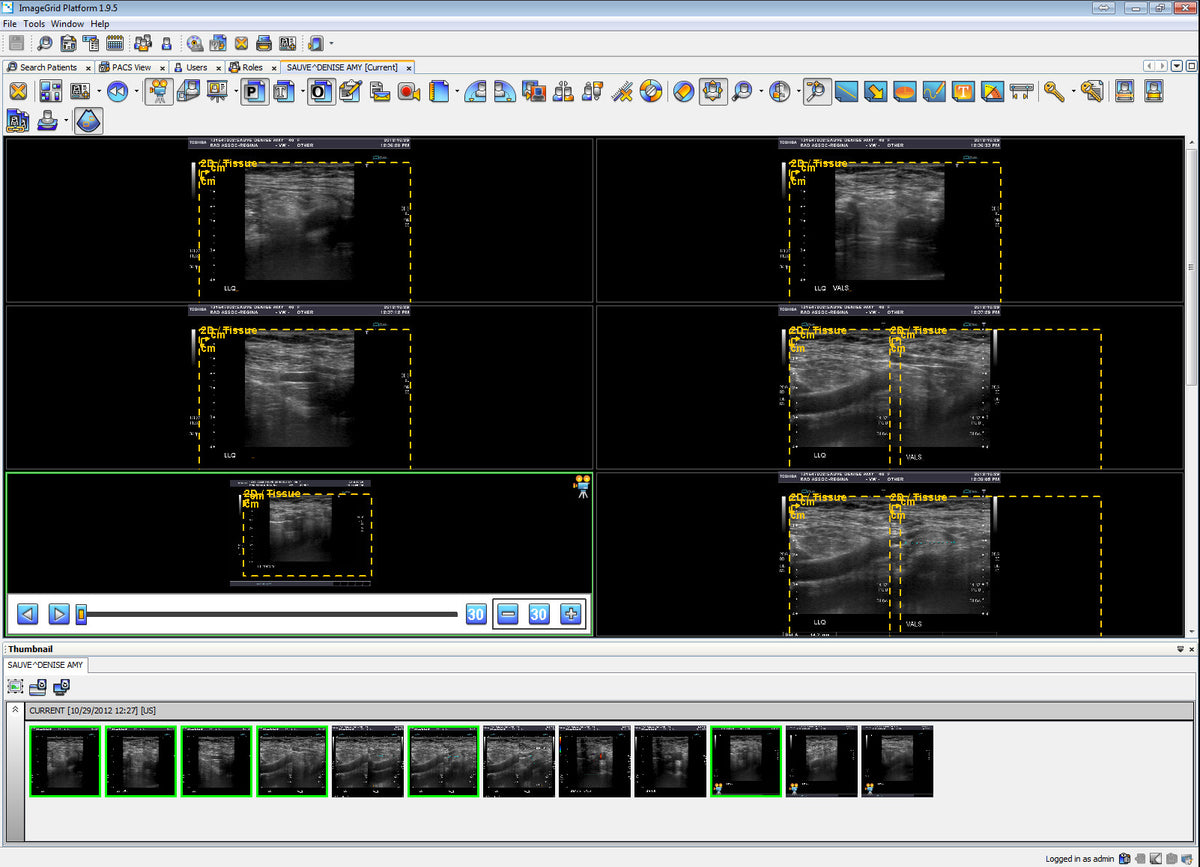 ImageGrid 9TB Mini-PACS System with DICOM Viewer and DICOM Storage ...